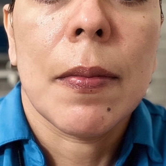 CT+ | Skincare | Ct Clear Therapy Lotion 50ml Beauty Bar 75g Serum ...